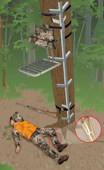 What Should Be on a Hunting Safety Checklist | ilearntohunt